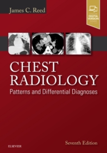 Chest Radiology : Patterns and Differential Diagnoses: James C., MD ...