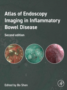 Atlas of Endoscopy Imaging in Inflammatory Bowel Disease: Bo Shen ...