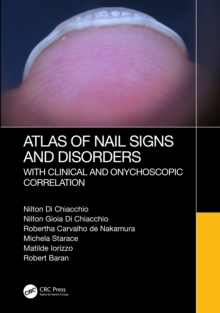 Atlas of Nail Signs and Disorders with Clinical and Onychoscopic ...