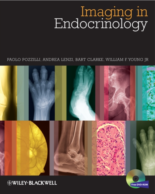 Imaging in Endocrinology: Paolo (Queen Mary University of London ...