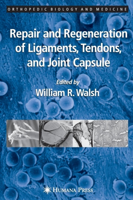 Repair and Regeneration of Ligaments, Tendons, and Joint Capsule ...