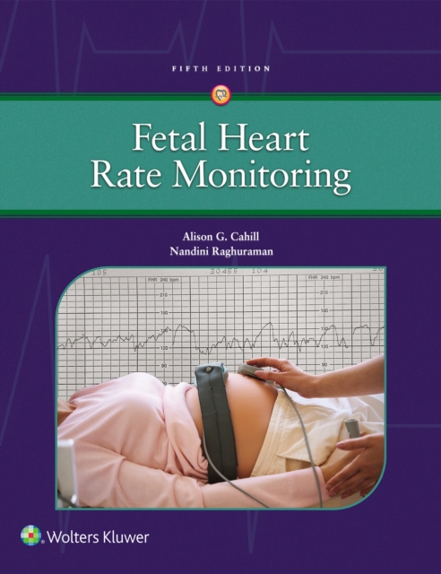Fetal Heart Rate Monitoring: Alison G. Cahill: 9781975216191: hive.co.uk