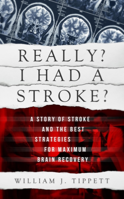 Really? I Had A Stroke? A Story of Stroke and the Best Strategies for ...